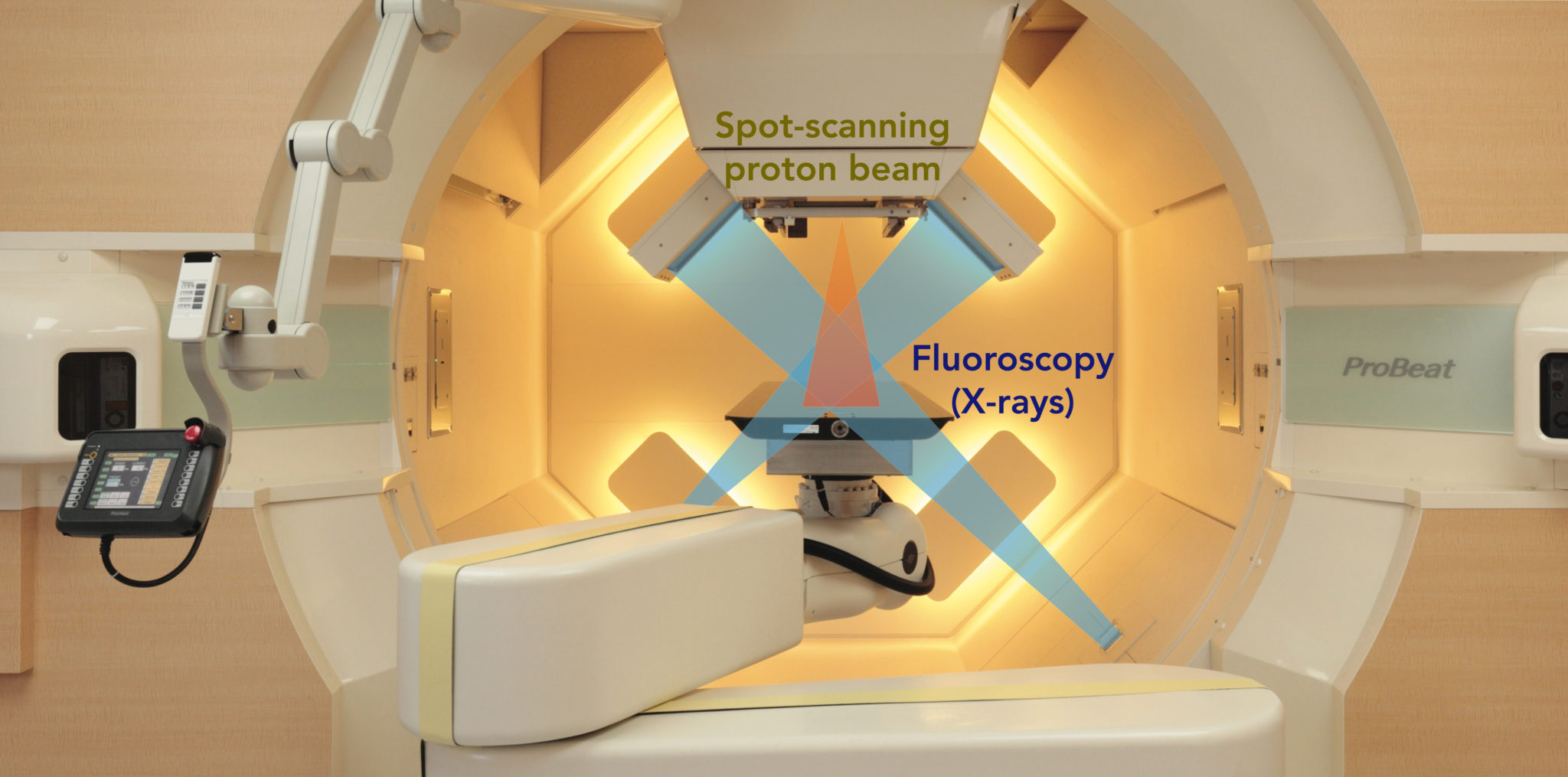 Spearheading global fight against cancer with proton therapy | Hokkaido ...