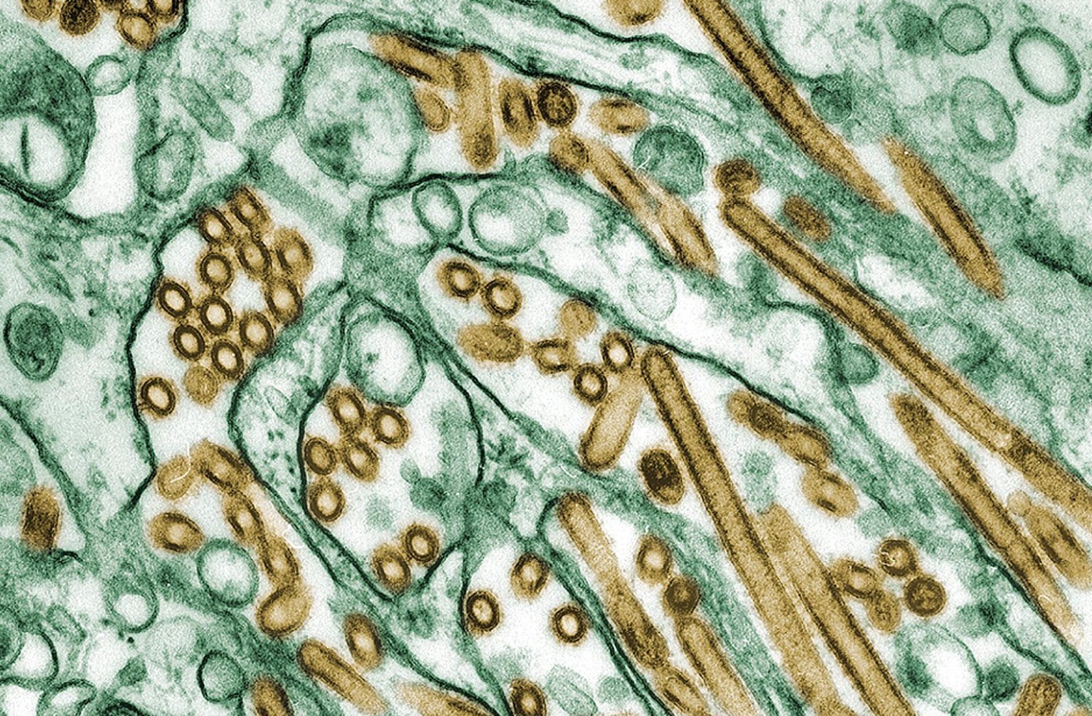 Working toward eradication of avian influenza | Hokkaido University