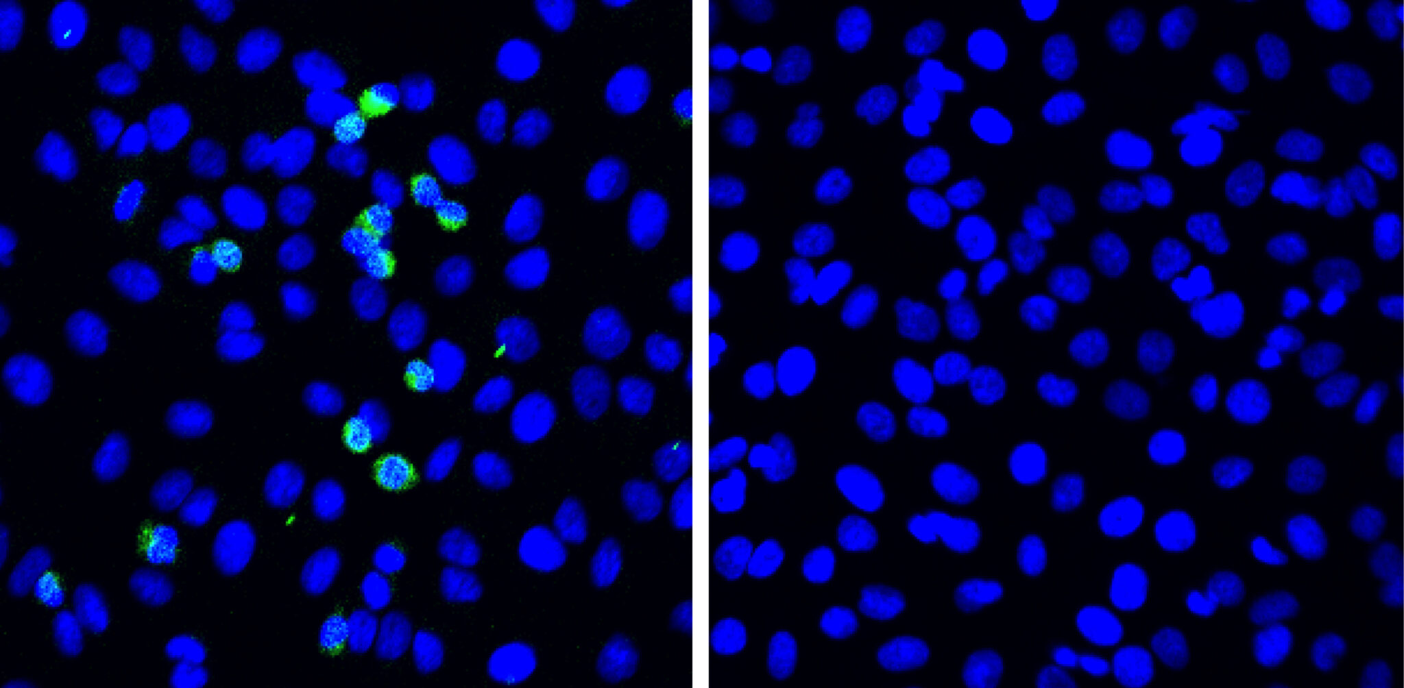 A novel defense mechanism for SARS-CoV-2 discovered | Hokkaido University